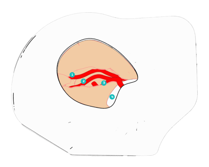 Surgical Simulation Models | Aneurysm Clipping | Surgeonslab